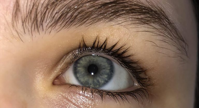 10 Rarest Human Genetics: Do You Have Any? - Big Edition