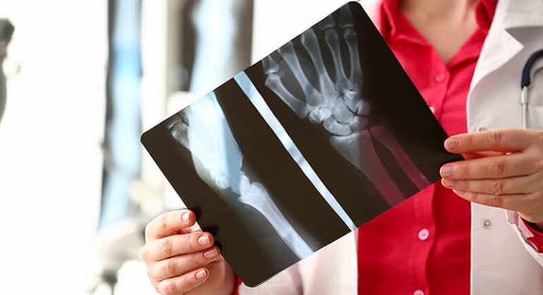 10 Rarest Human Genetics: Do You Have Any? - Big Edition