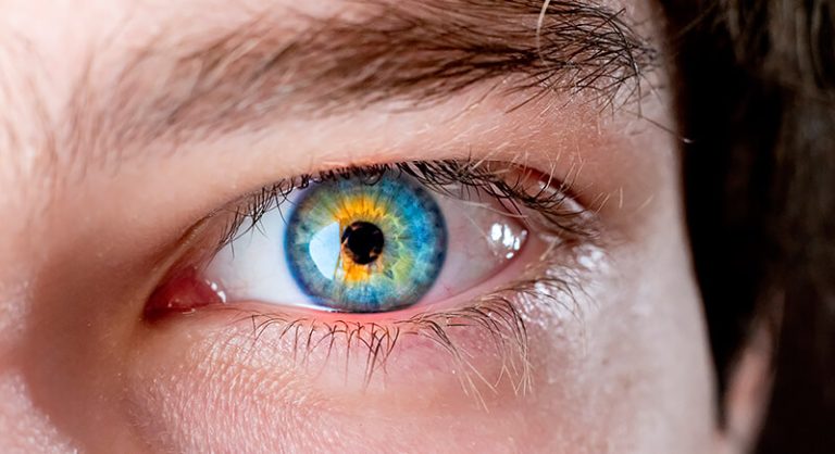 10 Rarest Human Genetics: Do You Have Any? - Big Edition